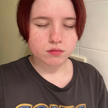 SkinB5™ Next generation Clear Skin + Wellness reviews | ProductReview ...