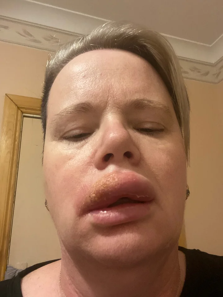 Virasolve Cold Sore Cream reviews | ProductReview.com.au