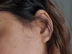 SkinB5™ Next generation Clear Skin + Wellness reviews | ProductReview ...