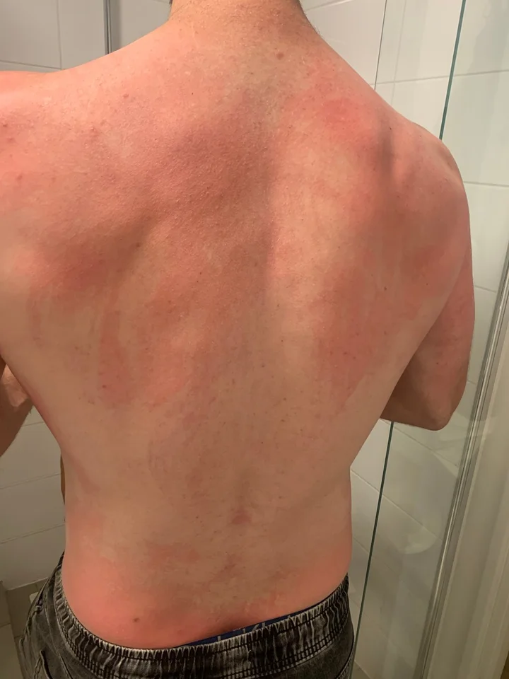 Ethical Zinc Natural Clear Zinc Sunscreen reviews | ProductReview.com.au