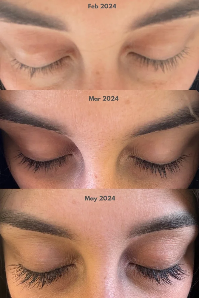 Xali Lash Growth Serum reviews | ProductReview.com.au