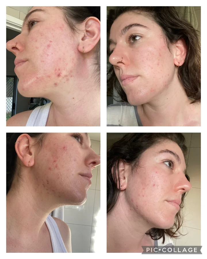 SkinB5™ Next generation Clear Skin + Wellness reviews | ProductReview ...