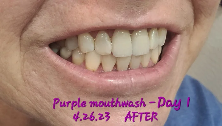 Hismile V34 Colour Corrector Serum reviews | ProductReview.com.au