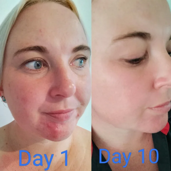 SkinB5™ Next generation Clear Skin + Wellness reviews | ProductReview ...