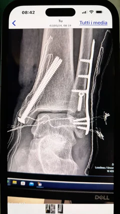 1Cover Travel Insurance reviews | ProductReview.com.au