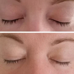 Xali Lash Growth Serum reviews | ProductReview.com.au