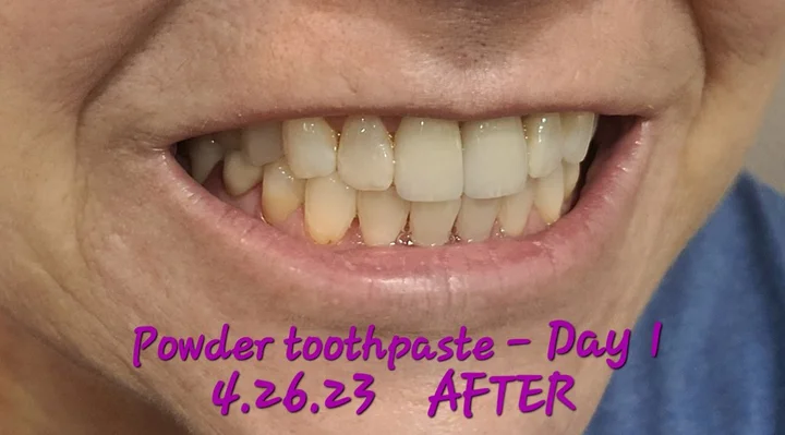 Hismile V34 Colour Corrector Serum reviews | ProductReview.com.au