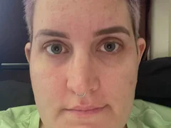 SkinB5™ Next generation Clear Skin + Wellness reviews | ProductReview ...