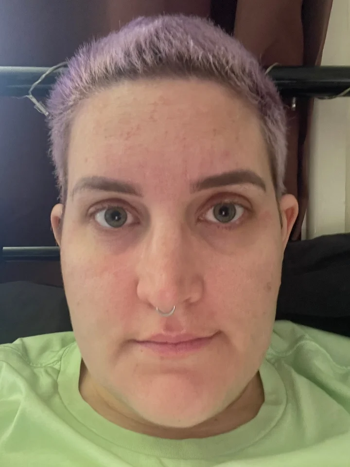 SkinB5™ Next generation Clear Skin + Wellness reviews | ProductReview ...