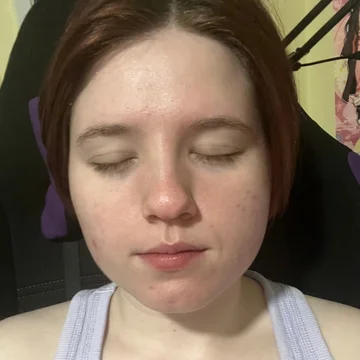 SkinB5™ Next generation Clear Skin + Wellness reviews | ProductReview ...